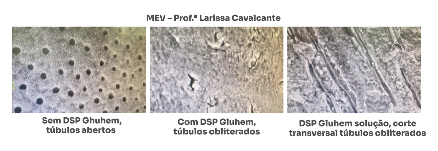 Descubra como aliviar a hipersensibilidade dentária de forma rápida e ...